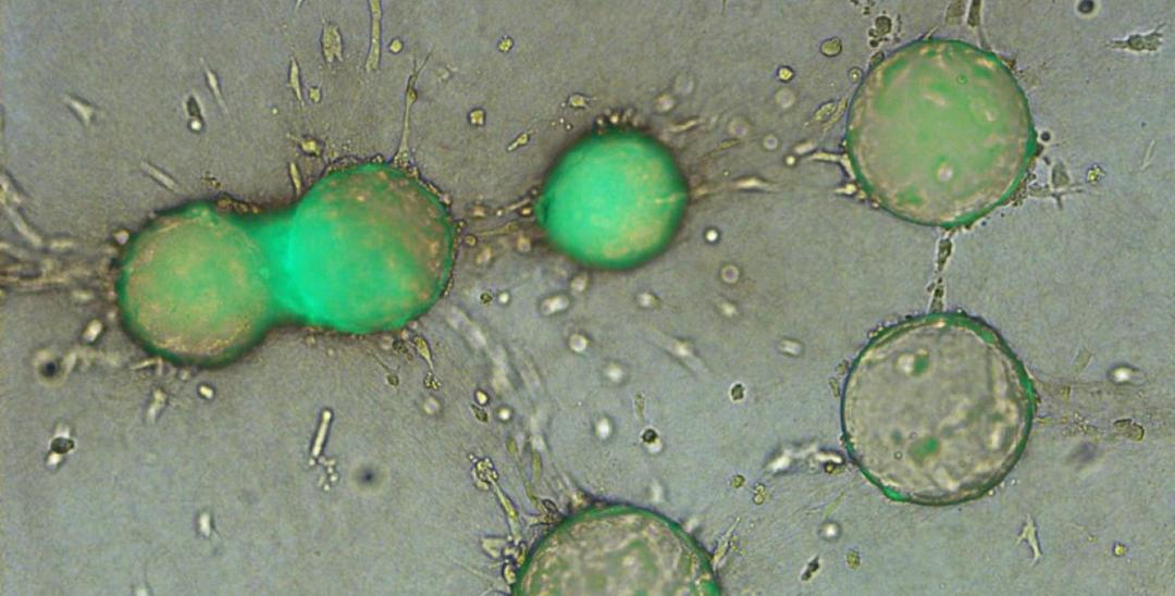 Tissue Engineering & Regenerative Medicine - Master | FHTW